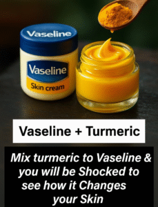 Vaseline and Turmeric: A Powerful Skin Remedy – TheirSearches